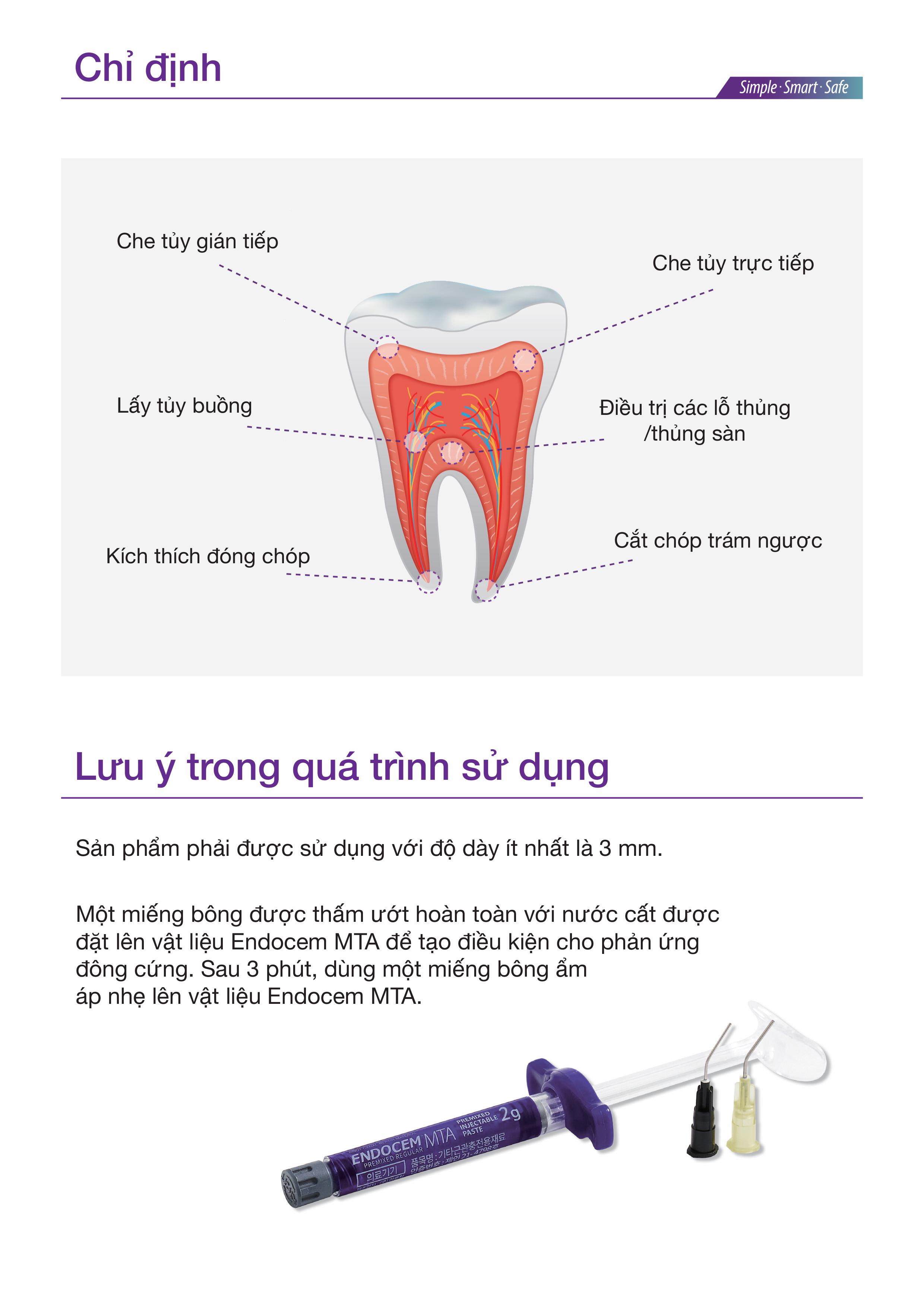 ENDOCEM MTA - Hải Nha - For The Better Dentistry
